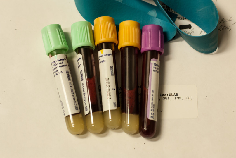 New blood preservation method - The Boar
