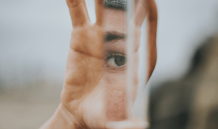 Perfect imperfections: representing scars and blemishes in advertising ...